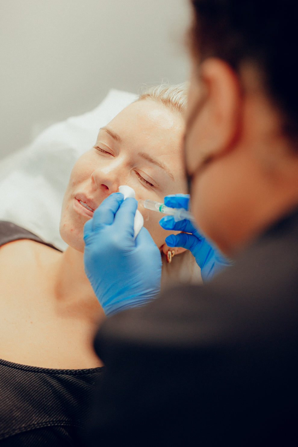 Nose to Mouth Line (Nasolabial Folds) – Aimee Victoria Long